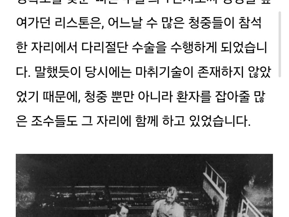 사망율 300%를 기록한 역사상 최악의 수술 | 유머 게시판 | RULIWEB